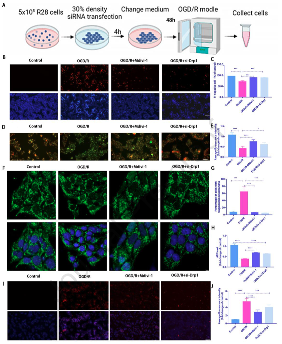 Redox Biology丨氧化应激顶刊丨病理性高眼压通过 Drp1 诱导线粒体功能障碍并导致PANoptosis - 知乎