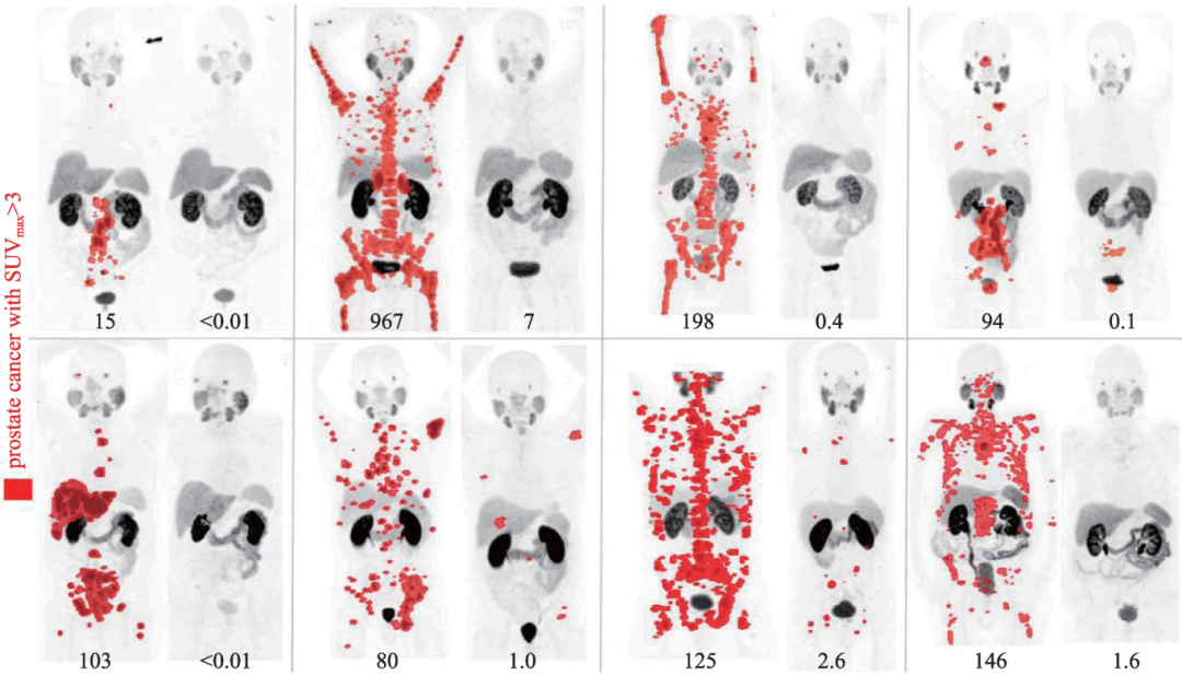 放射性药物简介 - 知乎
