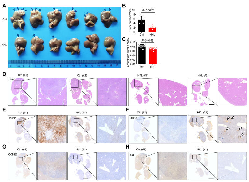 EMBO Rep | 中国科学技术大学王毅团队揭示CCNE2乳酸化修饰促进肝细胞癌进展的新机制 - 知乎