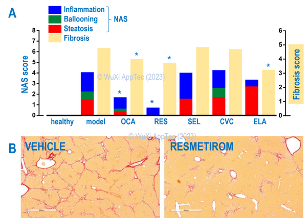 体内药理药效 | Resmetirom三期临床试验、THR-β及NASH新药临床前动物药效测试 - 知乎