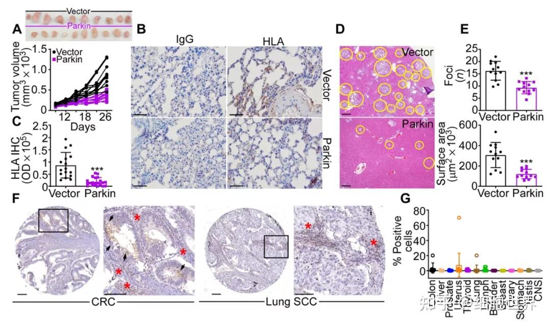 Sci Adv | 肿瘤泛素化组学揭示代谢重编程机理 - 知乎