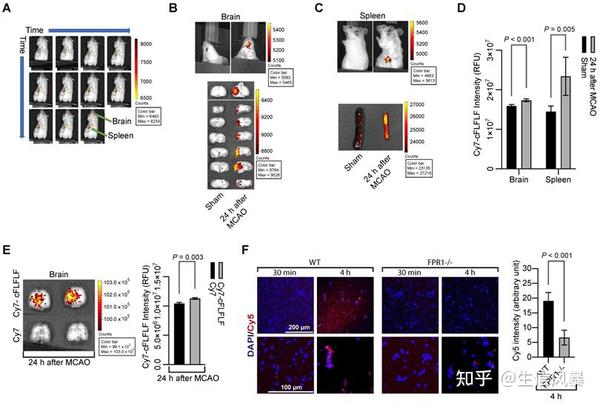 Theranostics：FPR1促进脾细胞迁移到大脑和促炎细胞因子的产生 - 知乎