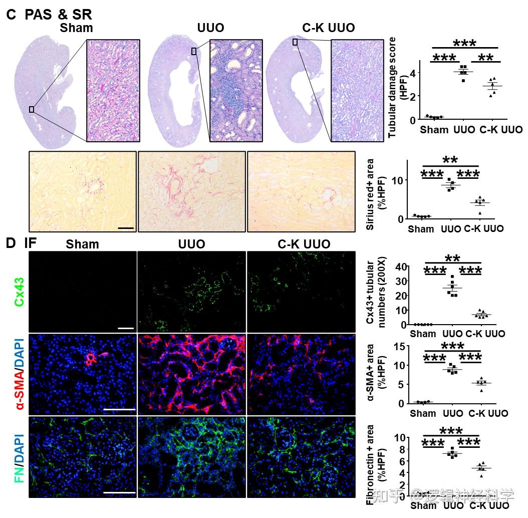 Cell Death Dis︱华中科技大学同济医学院姚颖/曾锐教授团队发现Connexin 43有望成为延缓肾间质纤维化进展的新靶 - 知乎