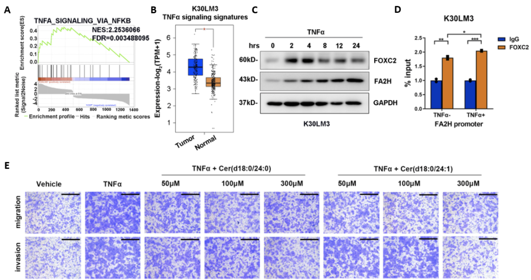 STTT︱刘芝华/吴楠团队揭示脂质代谢在癌症转移过程中的重要机制 - 知乎