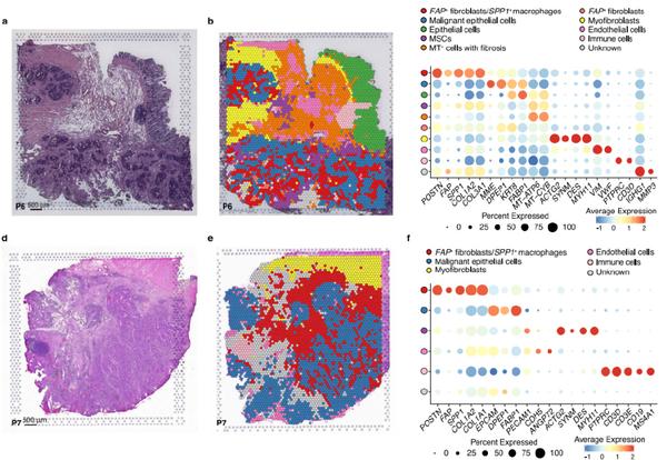 科研盘点 | 单细胞测序在结直肠癌研究中的应用 - 知乎