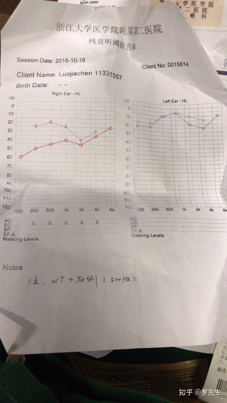 耳鸣,做了声导抗测听和纯音听阀测定报告不会看,谁愿意来解释一下报告里面的各项数据的意思呢呢? 知乎