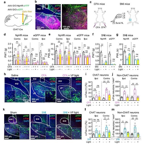 腹侧苍白球胆碱能环路调控慢性疼痛相关焦虑和抑郁情绪的神经环路机制 - 知乎