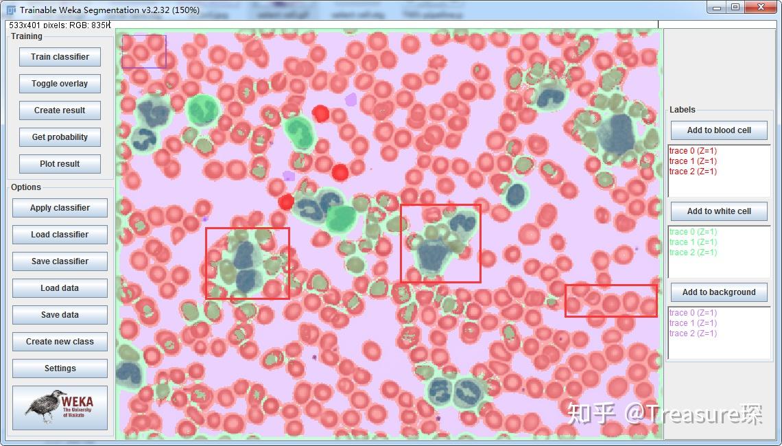 ImageJ实用技巧——基于机器学习的自动细胞分割(插件篇) - 知乎