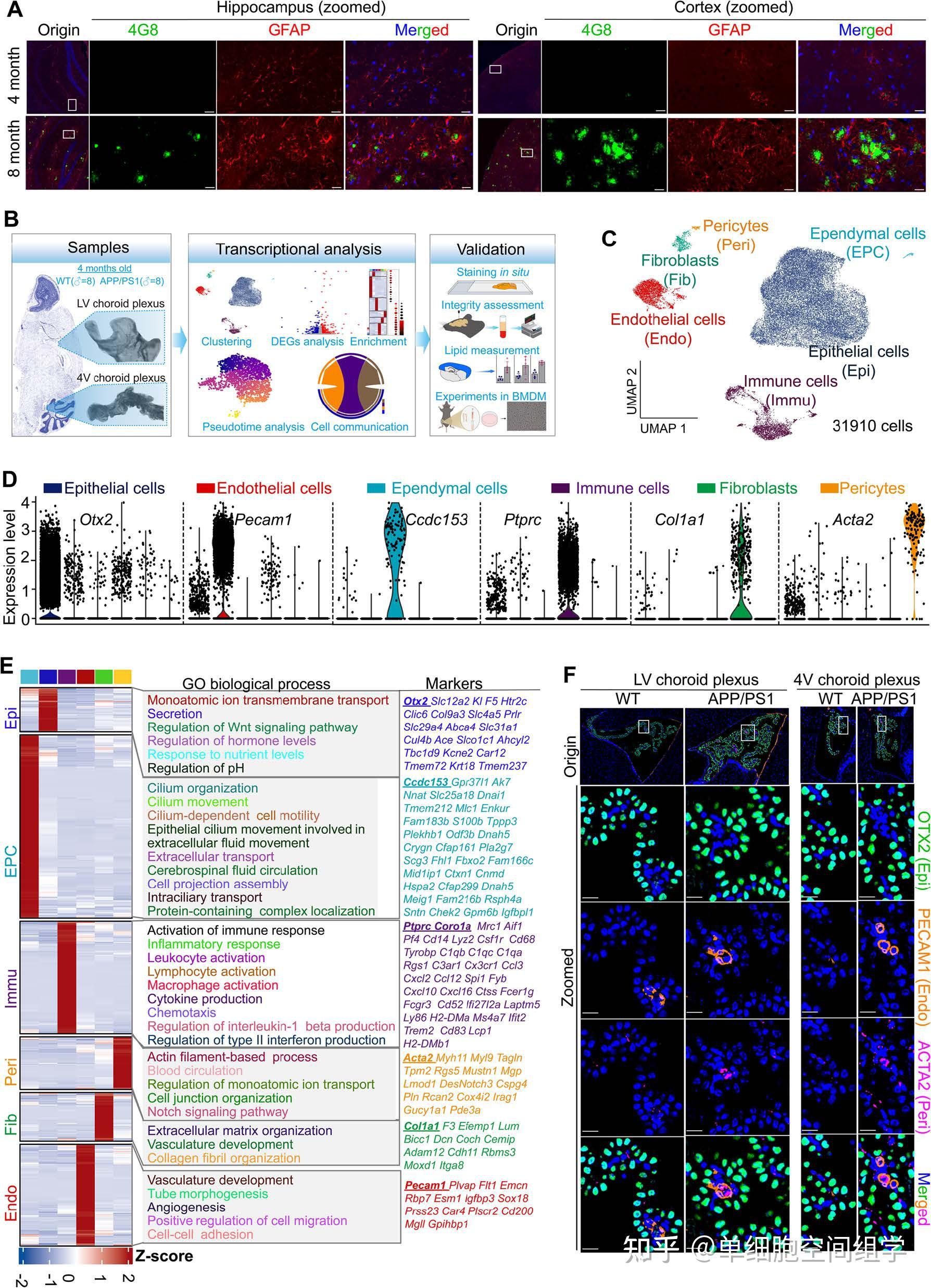 从亚细胞到组织层面：TissueGnostics 发现脉络丛上皮细胞损伤激活 AD 巨噬细胞极化的新通路 - 知乎