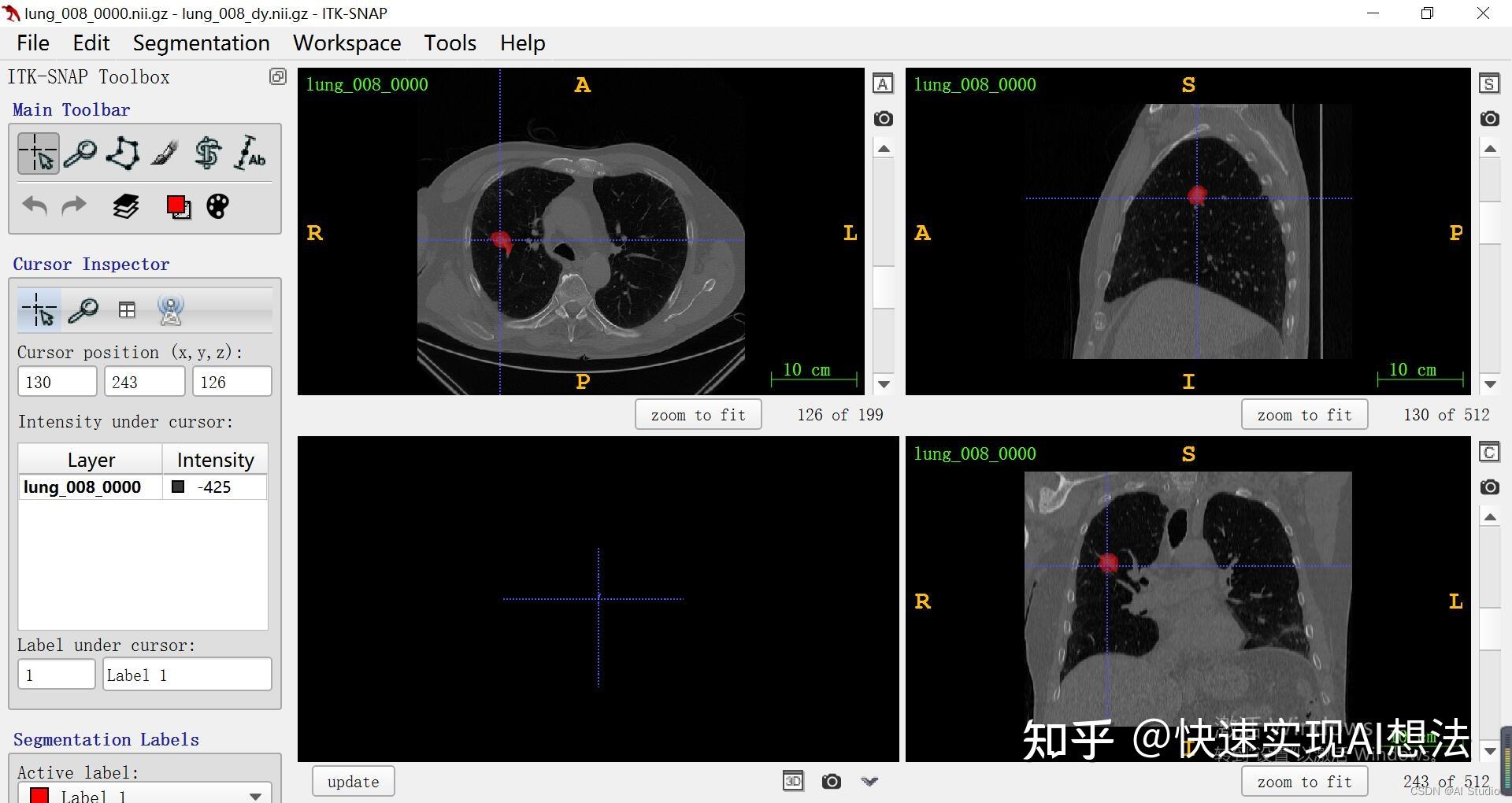 MedicalSeg-nnUNet使用教程 - 知乎