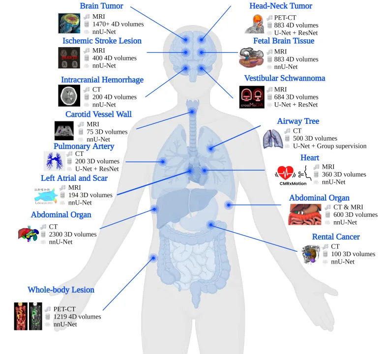 冠军方案大公开！MICCAI 2023 3D图像分割挑战赛 直播回放&问答文字版 - 知乎