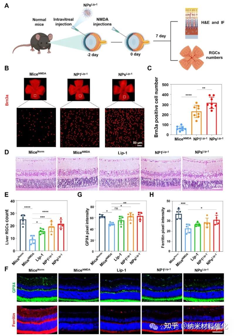 【Adv.Mater】铁螯合和活性氧清除聚合物与硫酮和硫醚键传递铁死亡抑制剂Lip‐1提供急性青光眼视网膜神经节细胞三联治疗策略 - 知乎