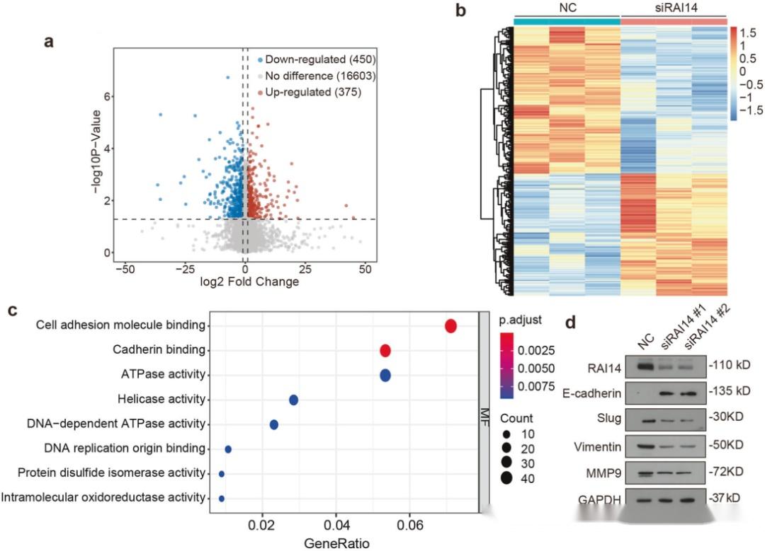 Exp Mol Med︱刘金保/陈鑫团队发现去泛素化酶STAMBP促三阴性乳腺癌进展新功能 - 知乎