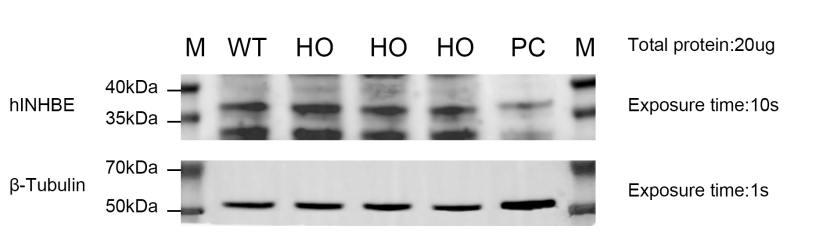 INHBE：减脂界冉冉升起的新星 - 知乎