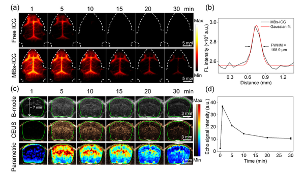 纳米材料 | 超声诱导以打开血脑屏障的 NIR-II 荧光可视化，用于使用ICG吲哚菁绿微泡增强光热治疗胶质母细胞瘤 - 知乎