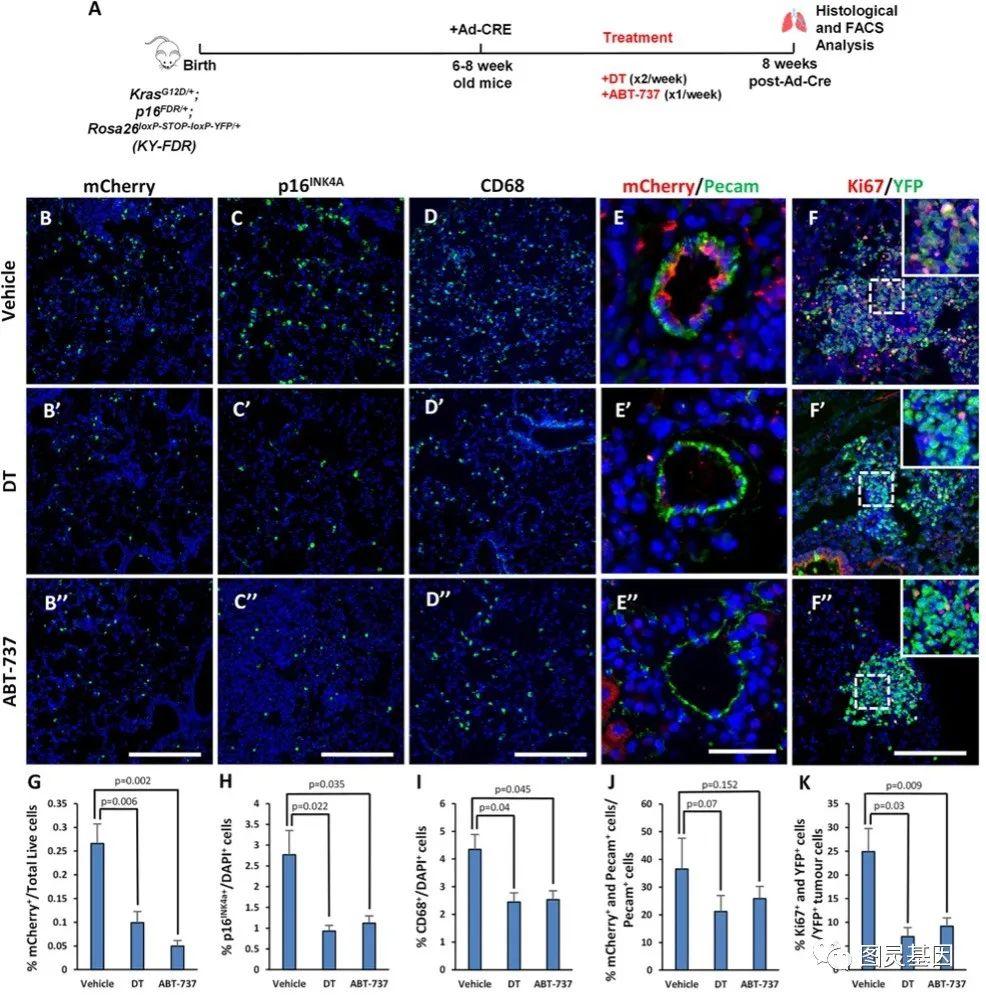 Cancer Cell｜衰老巨噬细胞清除后显著改善KRAS驱动的肺癌发生 - 知乎