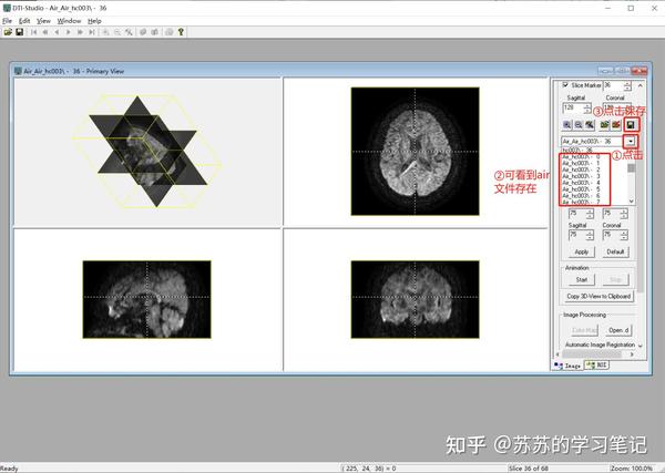 DTI Studio操作教程 - 知乎