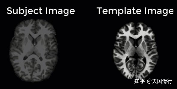 FSL 的核磁数据配准方法 - 知乎