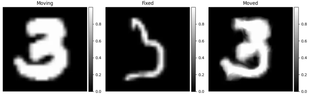 分割图——SynthMorph，零样本学习完成跨模态配准任务 - 知乎