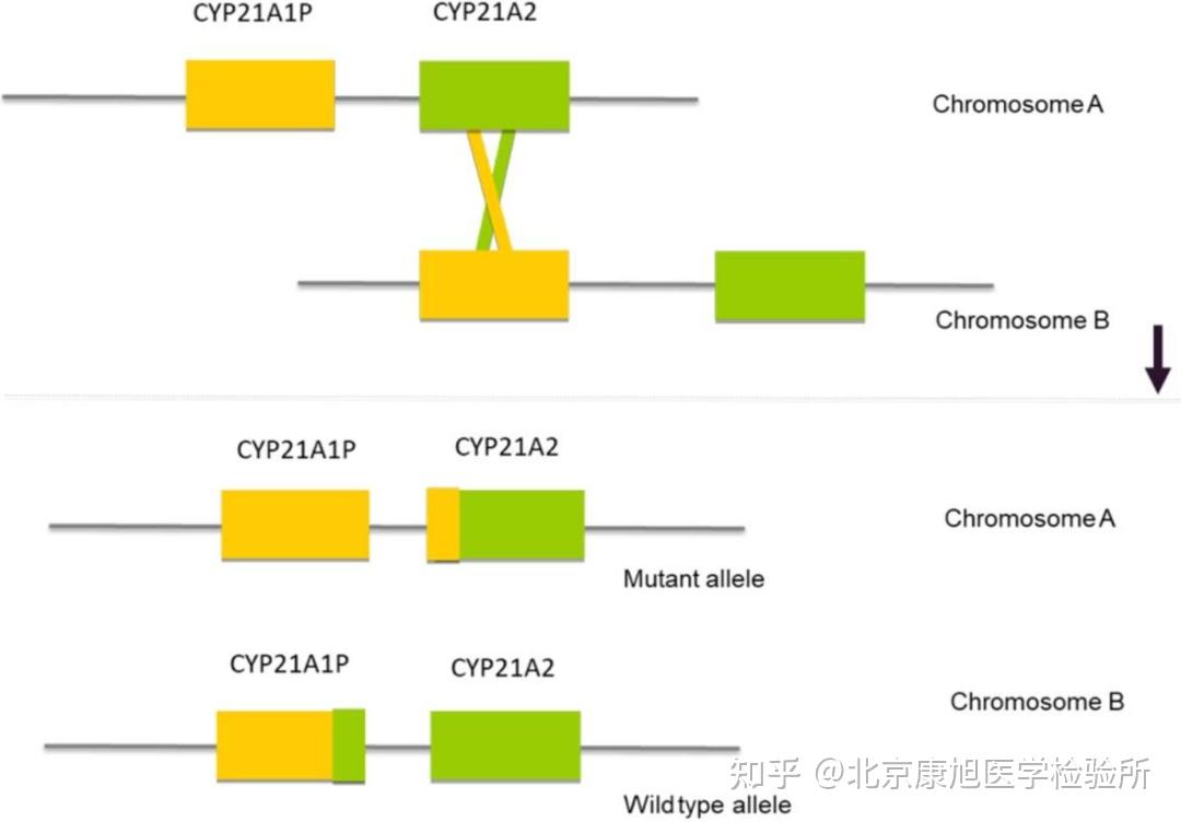 【遗传检测】先天性肾上腺皮质增生症(CAH) - 知乎