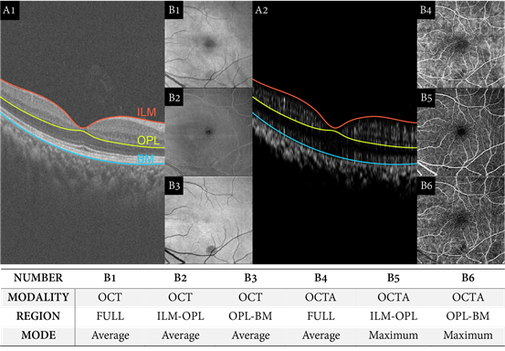 80GB医学影像数据集！OCTA-500公开发布 - 知乎