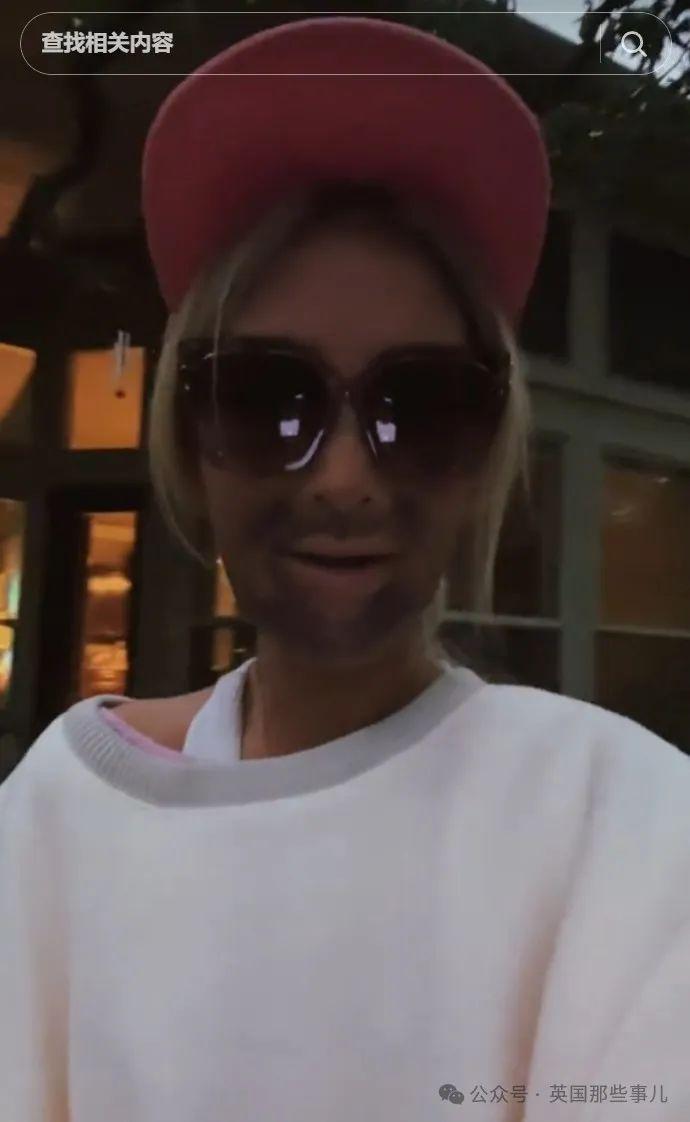 狠人老姐一次性拔全口牙，直接肿成熊猫，整张脸都黑了... - 知乎