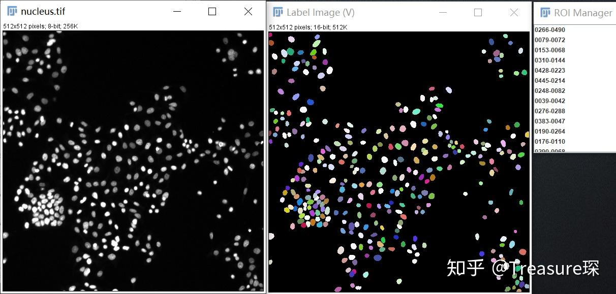 ImageJ实用教程——基于深度学习的细胞核自动分割（插件篇） - 知乎