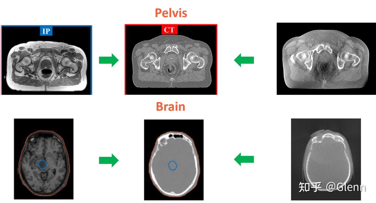 [医学图像竞赛] 推荐 | MICCAI'23 挑战赛速览 - 知乎
