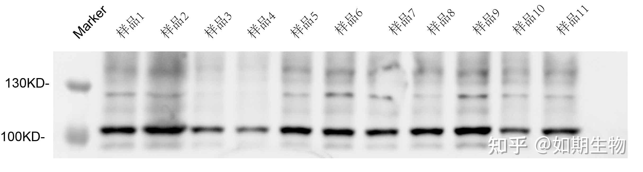 蛋白质印迹法图像结果分析WB检测技术 - 知乎