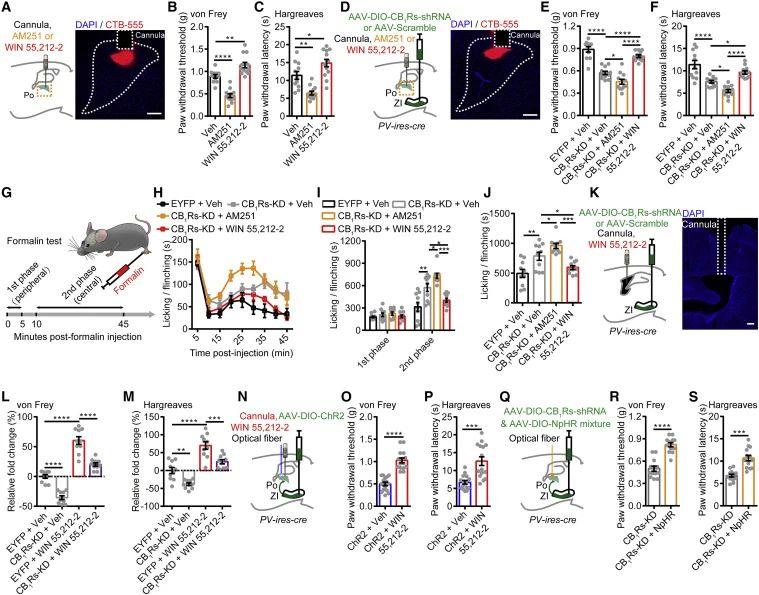 疼痛调节的Po-ZI通路 - 知乎