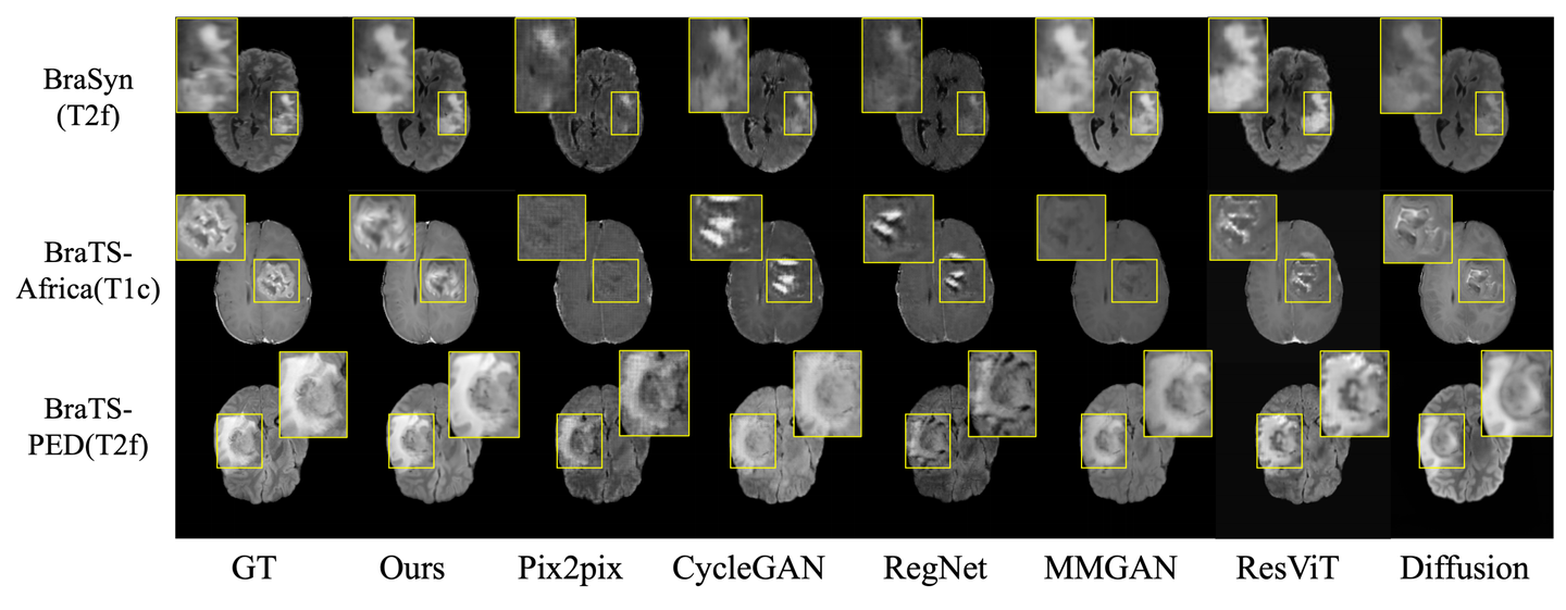 MICCAI 2025 | 多模态 MRI 跨模态生成新突破：用“不确定性”打造更可靠的医学影像合成 - 知乎