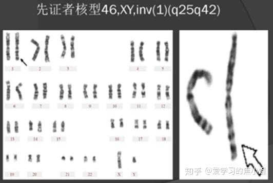 零基础版本-看懂核型报告 - 知乎