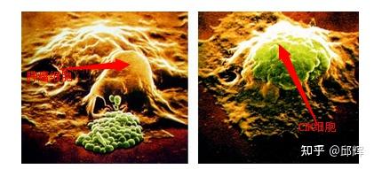 免疫细胞科普，CIK细胞和NK细胞有什么区别？ - 知乎