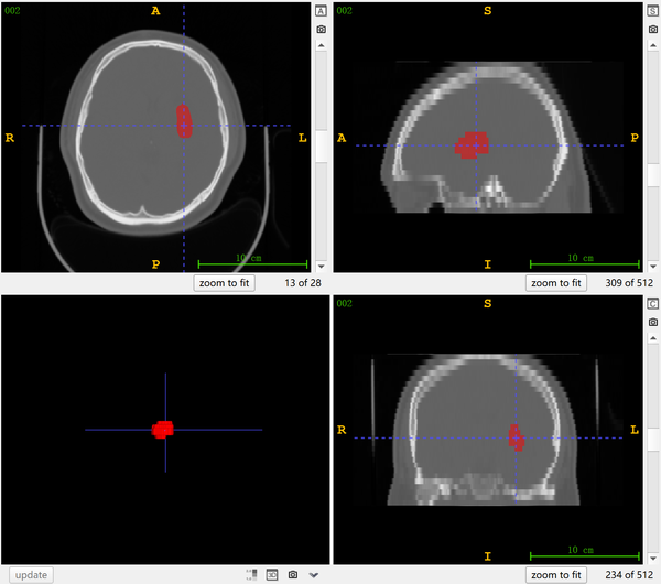 INSTANCE 2022 数据集介绍 - 知乎