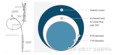 人工心脏4——一文浅析短期PVAD（上） - 知乎