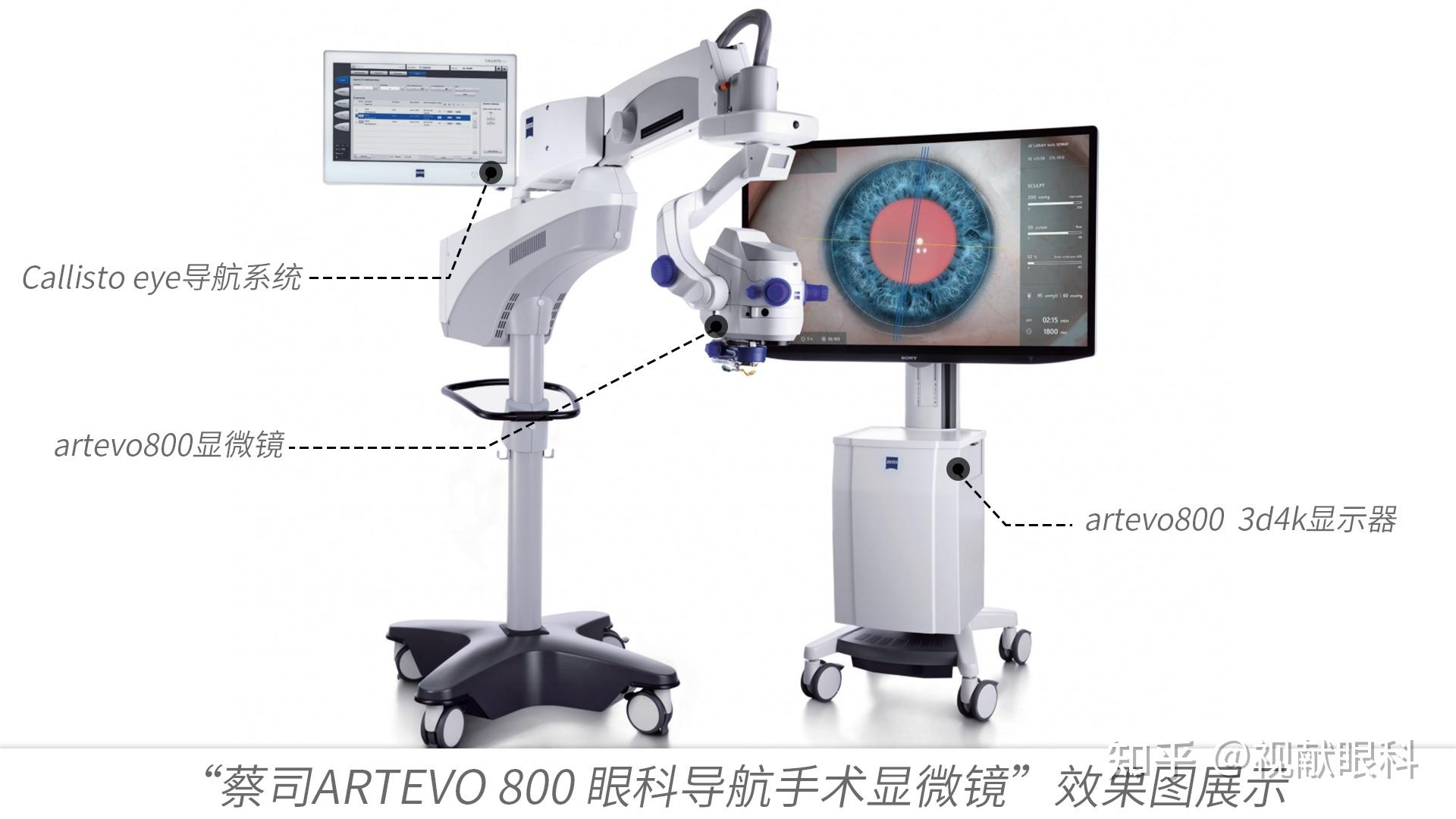 国内第二例3D导航显微镜ICL晶体手术在视献眼科完成！ - 知乎