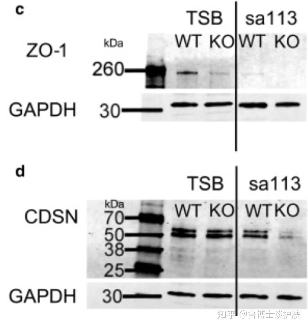 S1PR2是维持皮肤屏障稳态的关键蛋白 - 知乎