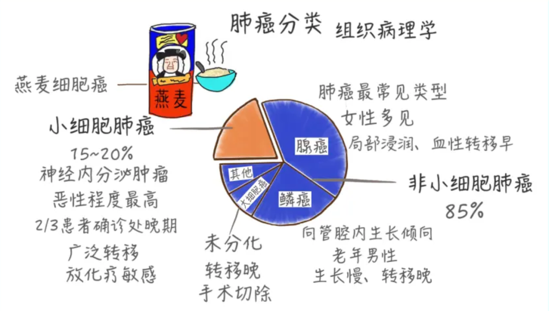 肺结节已切除，又新发结节是怎么回事... - 知乎