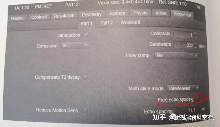 磁共振参数之回波间隔 - 知乎
