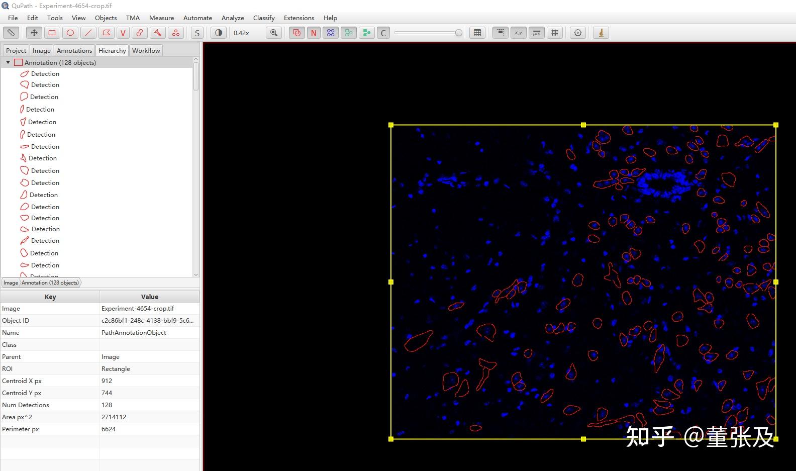使用QuPath+Cellpose+StarDist分析蛋白入核比率 - 知乎