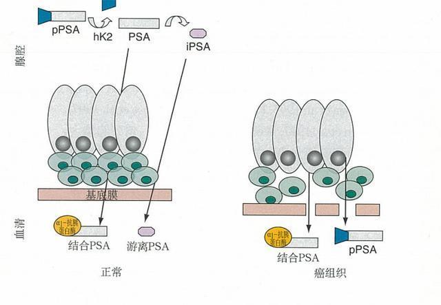 你知道PSA是什么吗？为什么PSA能够作为前列腺癌的诊断指标？ - 知乎
