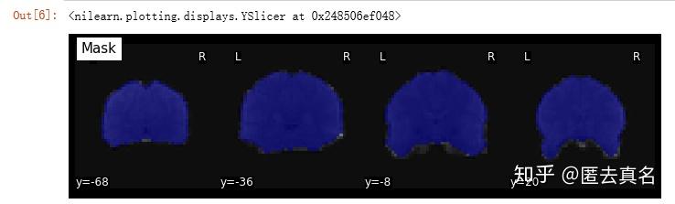 nilearn 笔记（16） - 知乎