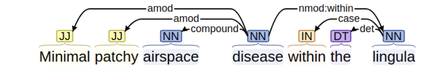 [论文笔记] When Radiology Report Generation Meets Knowledge Graph - 知乎