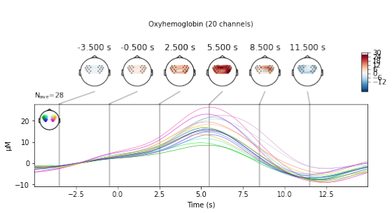 MNE/Python-fNIRS近红外数据处理中文手册 - 知乎