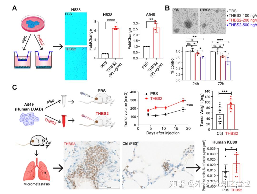 项目文章：组织外泌体助力解析TME明星分子THBS2促进早期肺腺癌侵袭转移机制 - 知乎