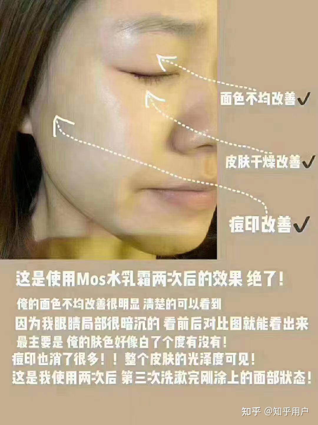 主营Mos／𝙋𝙐𝙂𝙀𝙀产品！护肤瘦身 美白祛痘！想咨询了解的dd我！ - 知乎