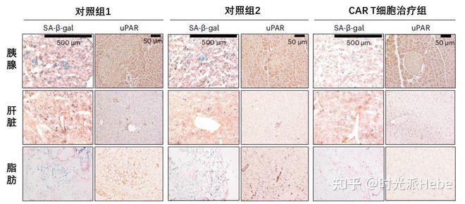 “抗衰疫苗”来了？一次治疗，半生有效！uPAR-CART衰老细胞清除剂发明者最新研究成果公布 - 知乎