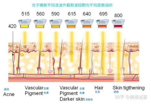 光子嫩肤仪器全科普|IPL、OPT、AOPT、DPL、ATP、BBL - 知乎