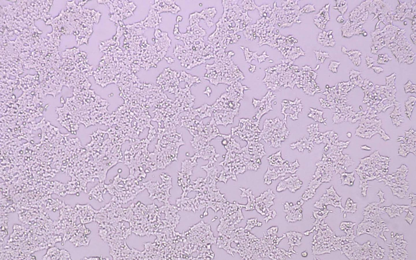 293T细胞在显微镜下的形态 - 知乎