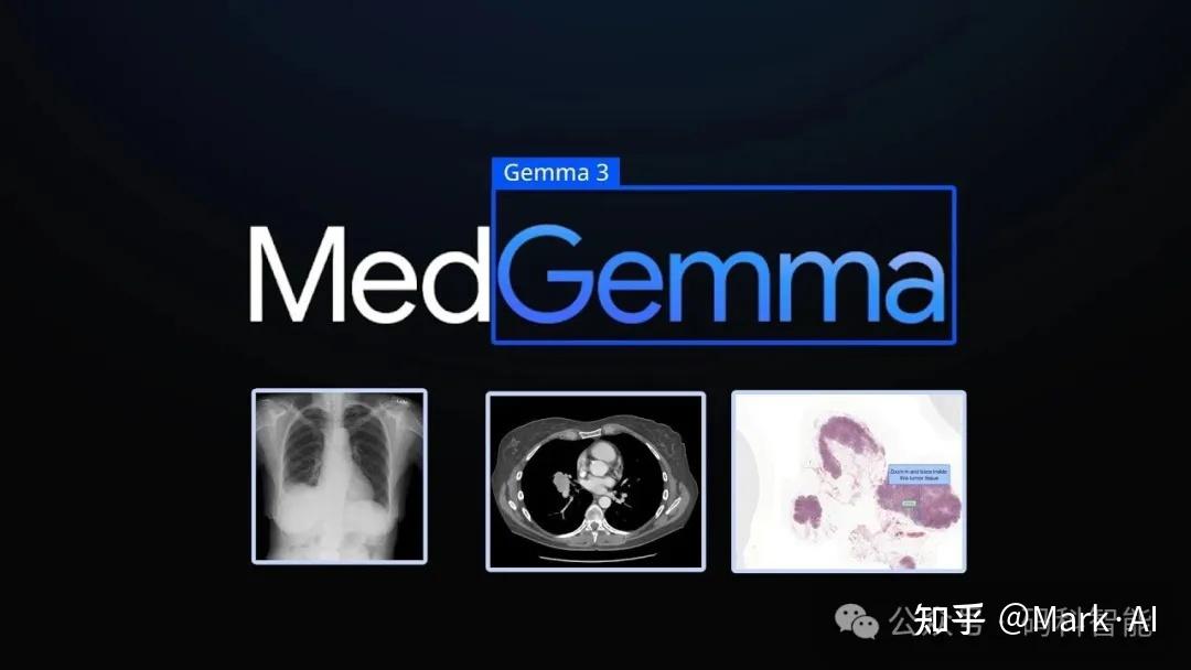 谷歌 MedGemma 医疗多模态大模型开源，X光片、皮肤图像、病理切片均可解析 - 知乎